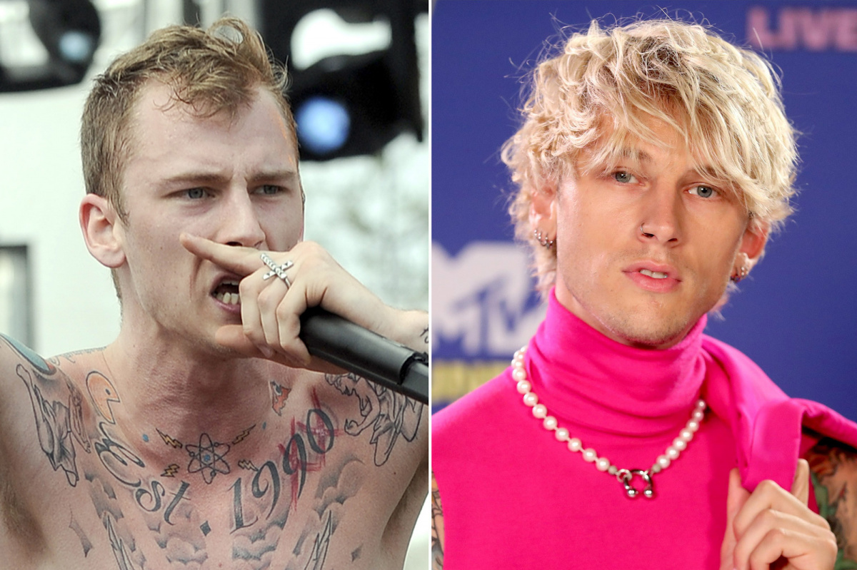 Machine Gun Kelly’s 2020 VMA’s look sparks hair transplant questions