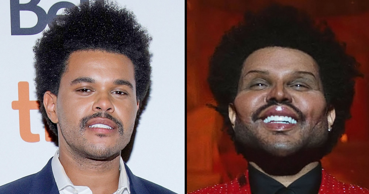 The Weeknd Prompts Plastic Surgery Rumors With New Look in Music Video