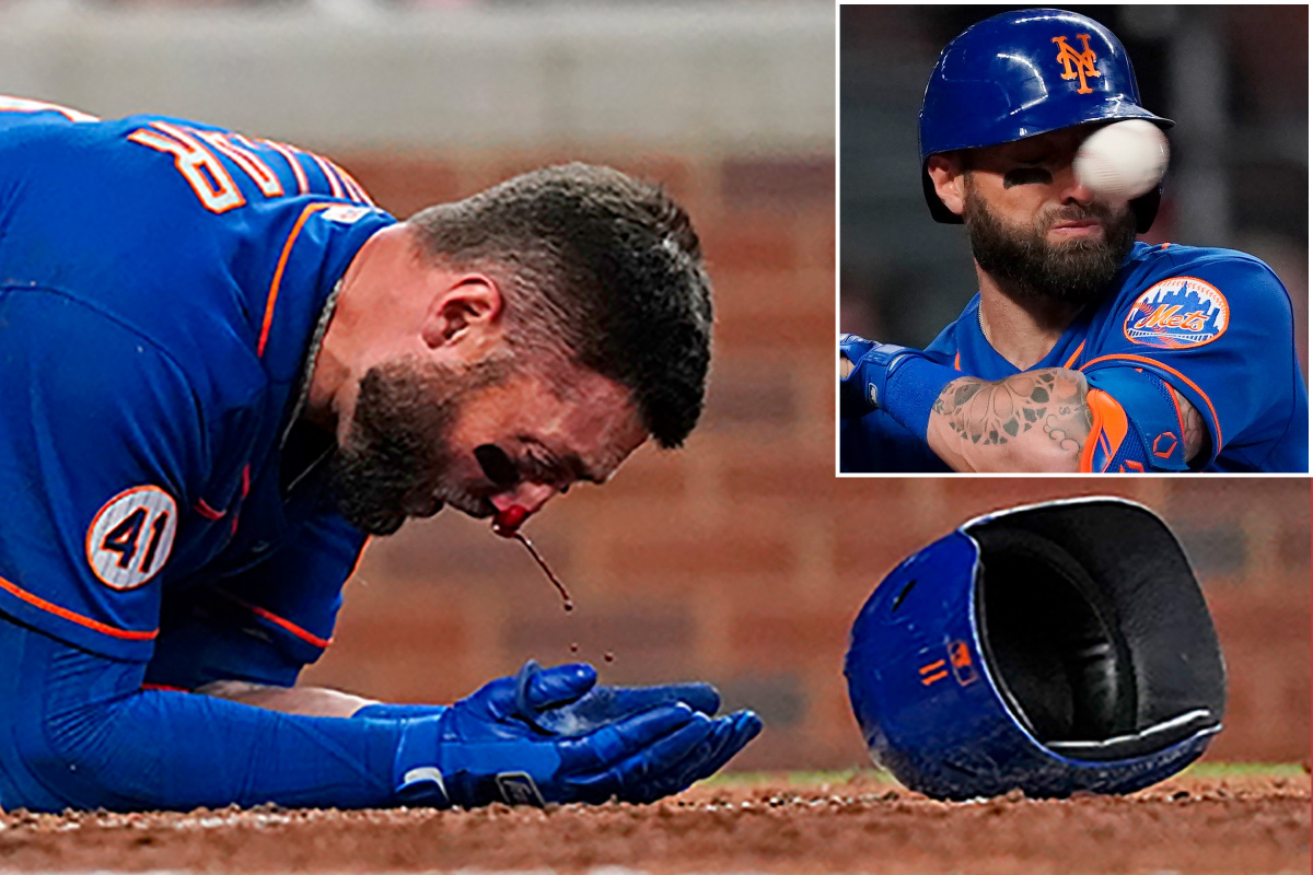 Mets’ Kevin Pillar gushes blood after taking pitch to face