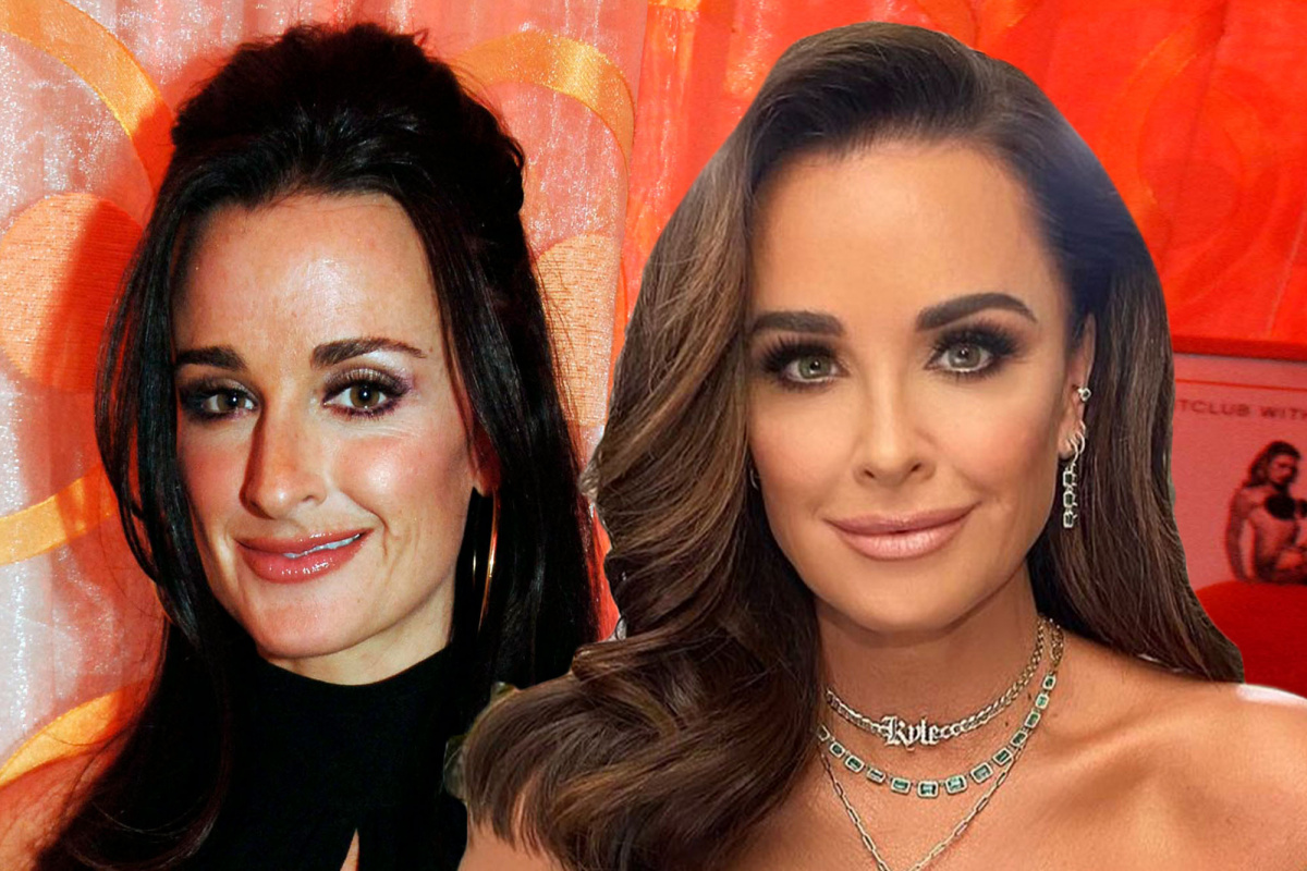 Kyle Richards, then and now: The ‘RHOBH’ star’s changing face in photos