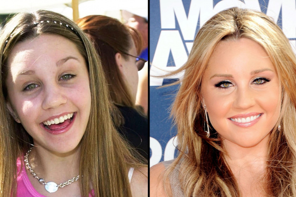 Happy 35th Birthday! Amanda Bynes Through the Years