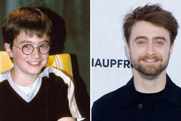 Daniel Radcliffe Through the Years: 'Harry Potter,' Broadway and Beyond