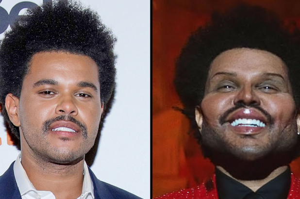 The Weeknd Prompts Plastic Surgery Rumors With New Look in Music Video